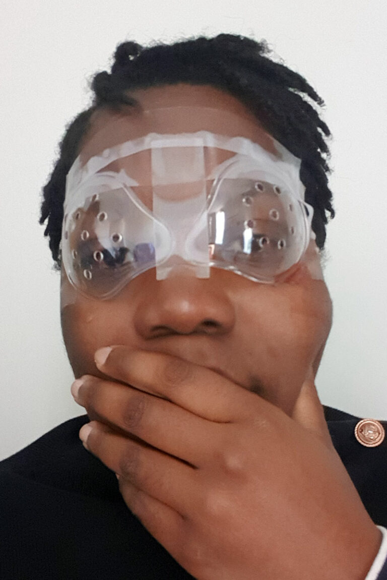 Opération du strabisme : mon témoignage (avec photos)